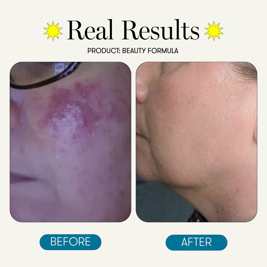 Get Glowing Beautiful Skin With The Beauty Formula – Equi London